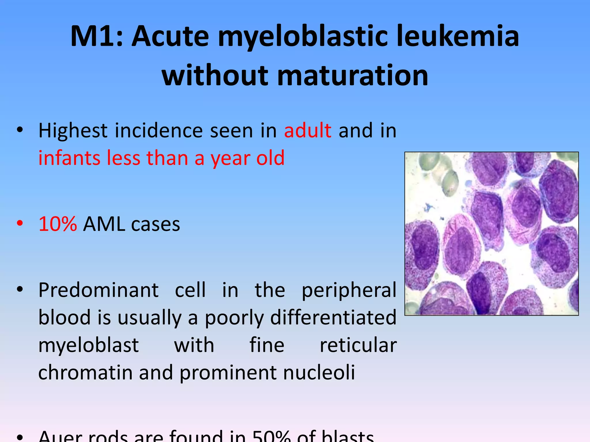 Acute leukemia | PPTX