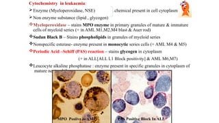 Lecture on acute leukemia containing AML and C | PPT