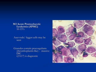 Acute leukemias | PPTX