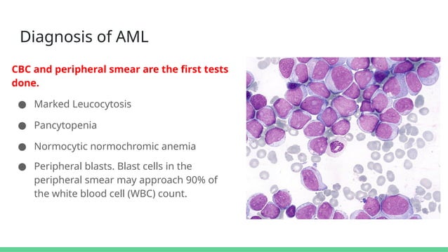 ACUTE LEUKEMIAS presentation made by medical students | PPTX