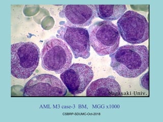 Acute leukemias aml-csbrp | PPT