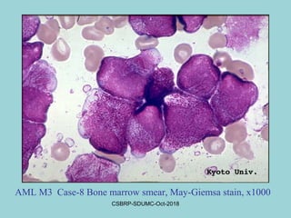 Acute leukemias aml-csbrp | PPT