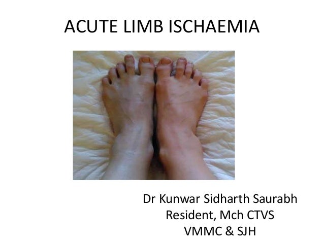 Acute limb ischaemia