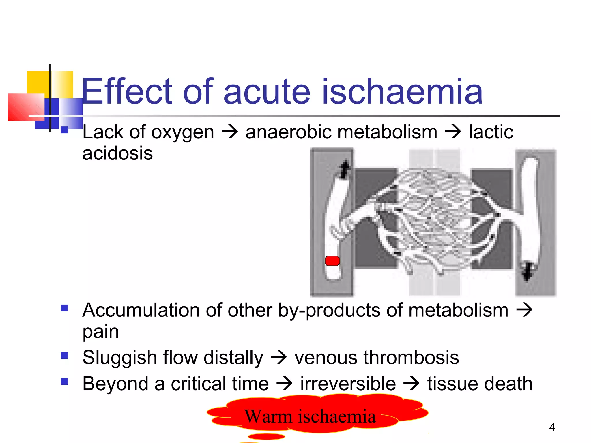 Acute limb ischaemia | PPT