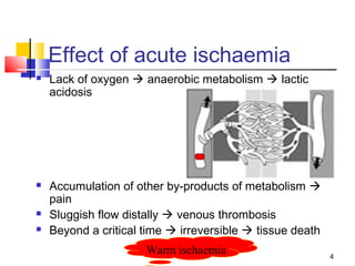 Acute limb ischaemia | PPT