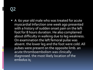Acute limb ischaemia usjp 2020 | PPT