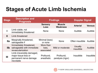 Acute Limb Ischemia | PDF