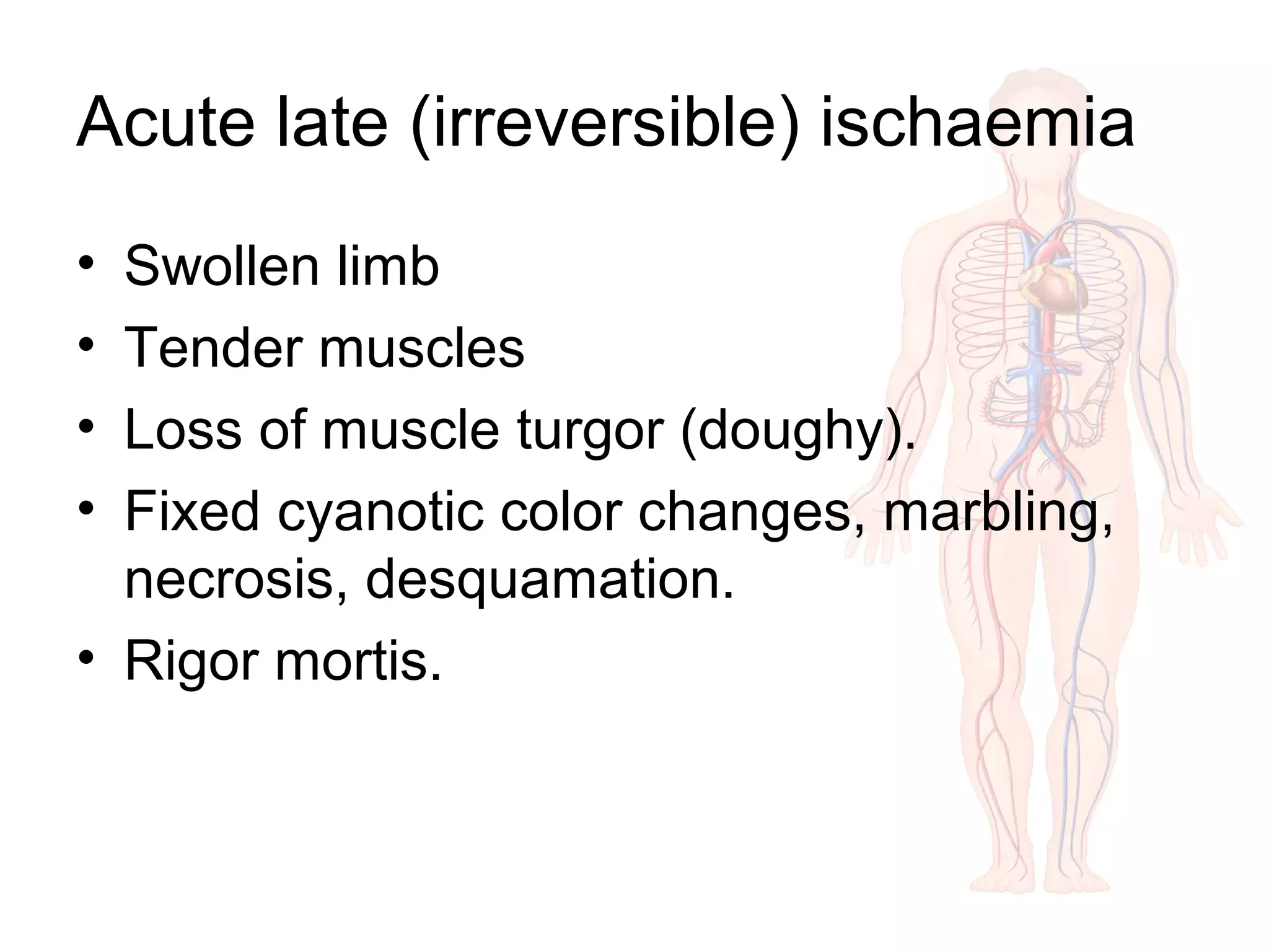 Acute limb ischemia | PPT