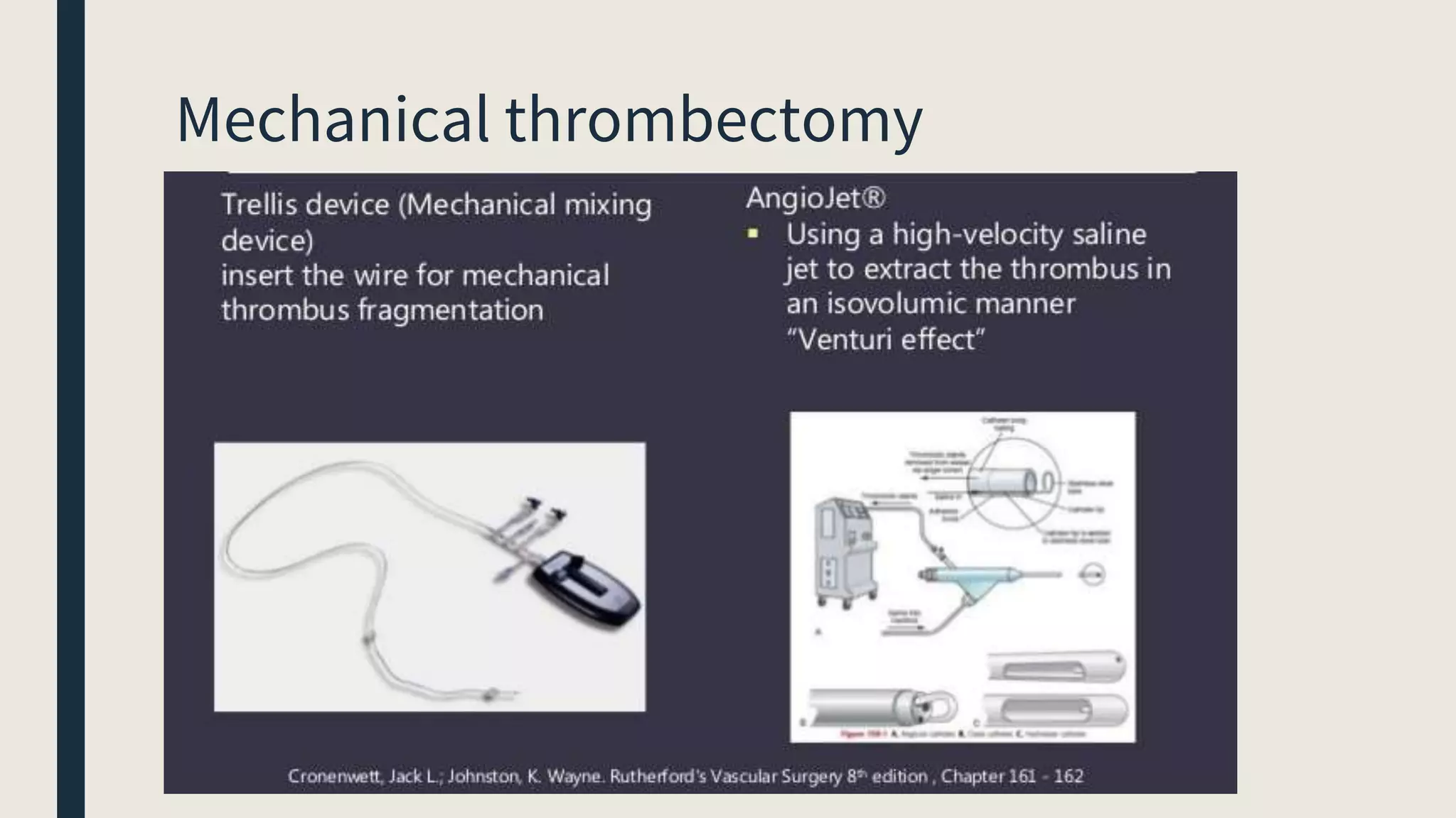 Acute limb ischemia | PPTX