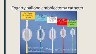 Acute limb ischemia | PPTX