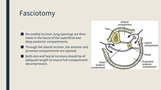 Acute limb ischemia | PPTX