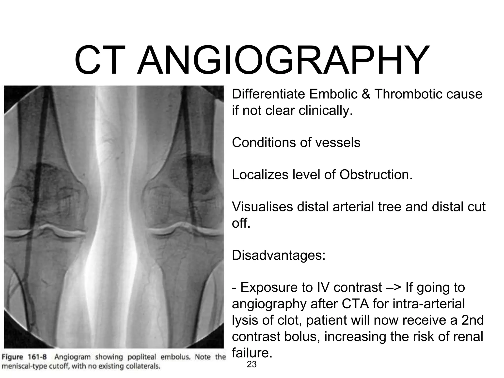 Acute limb ischemia (ALI) | PPTX