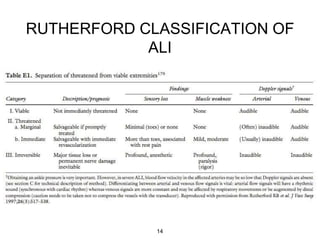 Acute limb ischemia (ALI) | PPTX