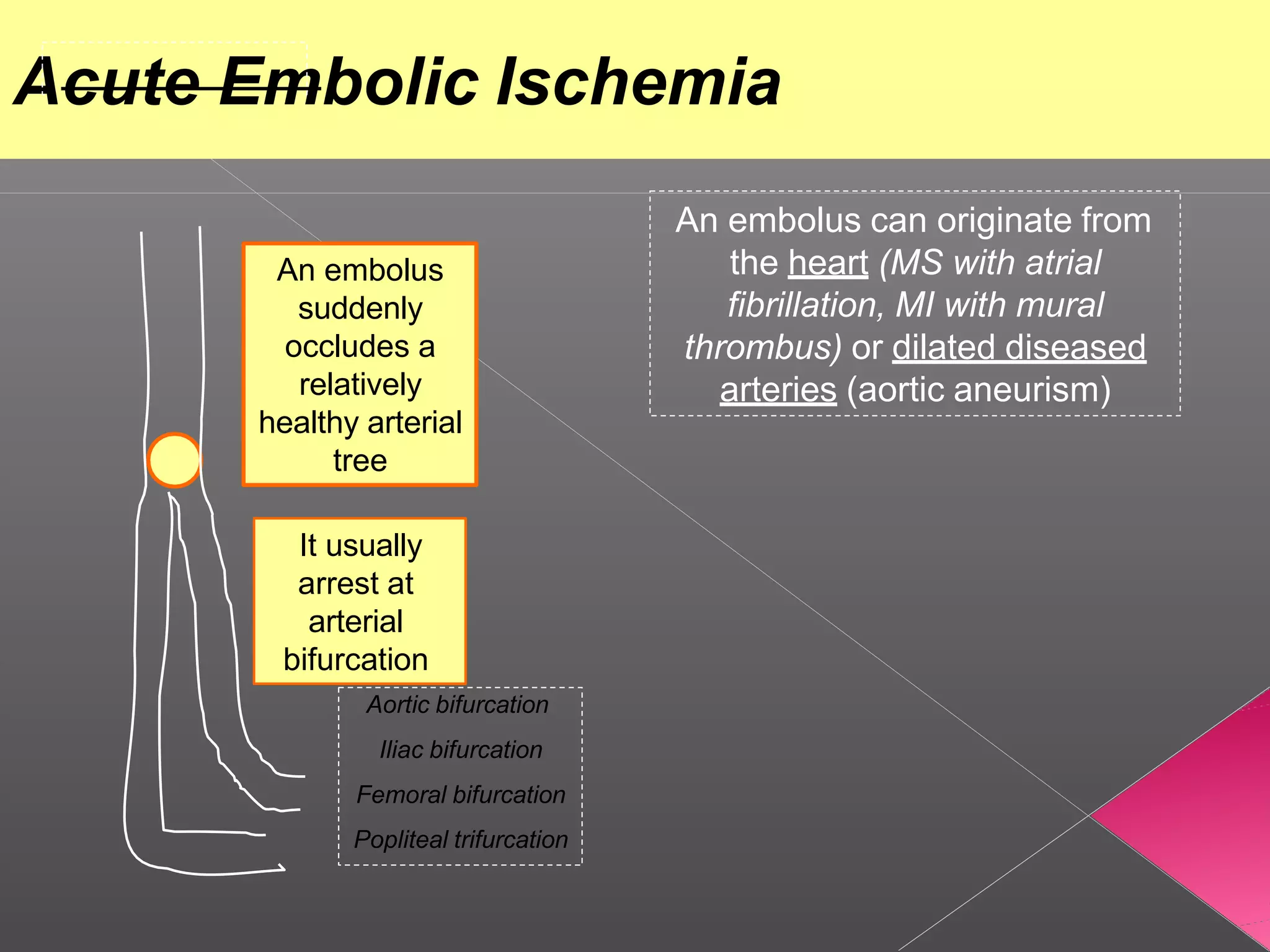 Acute limb ischemia | PPTX