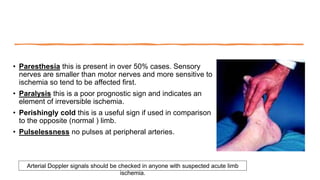 Acute Limb Ischemia | PPSX