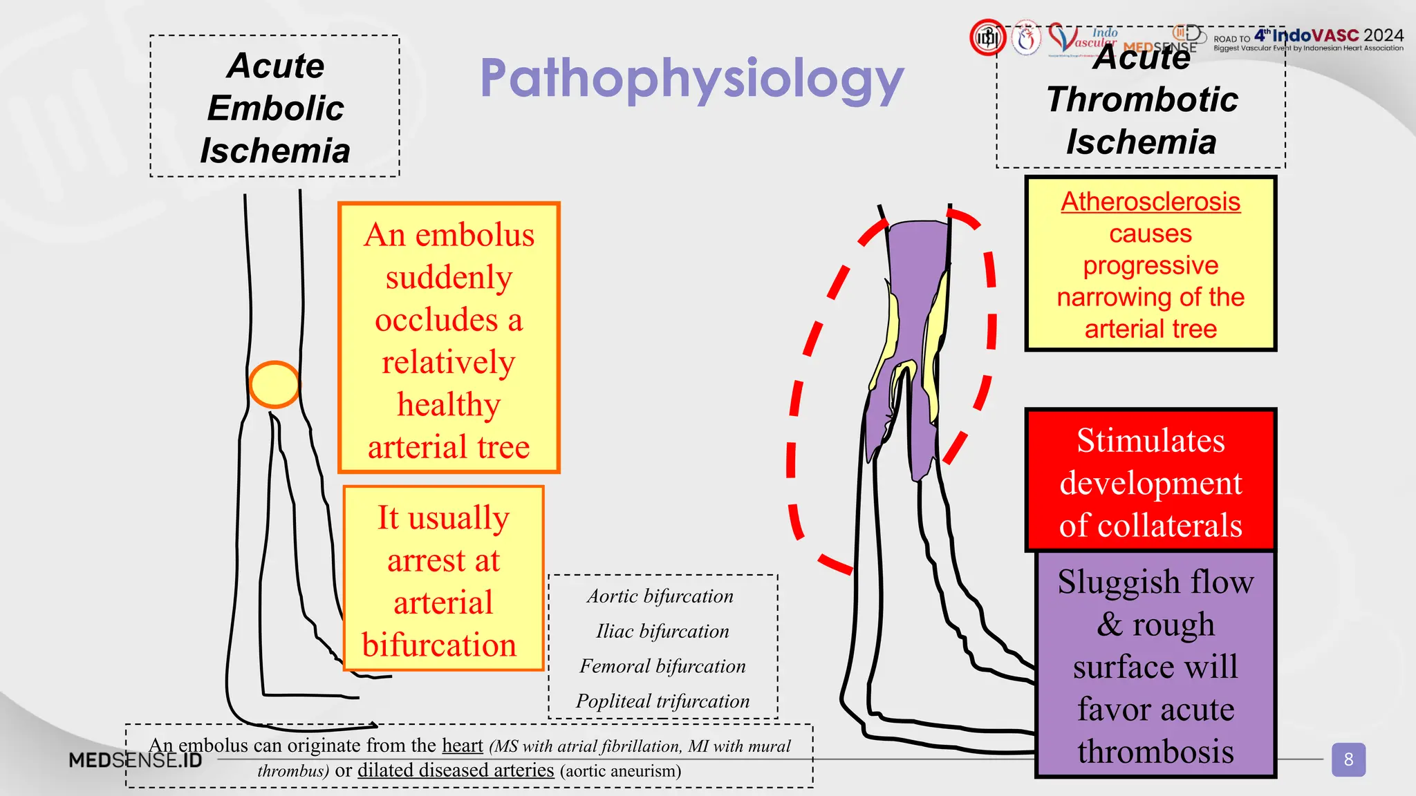 Acute Limb Ischemia and Role of DOAC.pptx