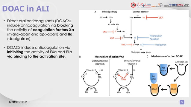 Acute Limb Ischemia and Role of DOAC.pptx