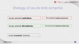 Acute Limb Ischemia and Role of DOAC.pptx