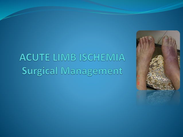 Acute Limb Ischemia Surgical Management Pptx