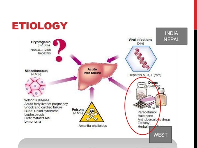 Acute liver failure