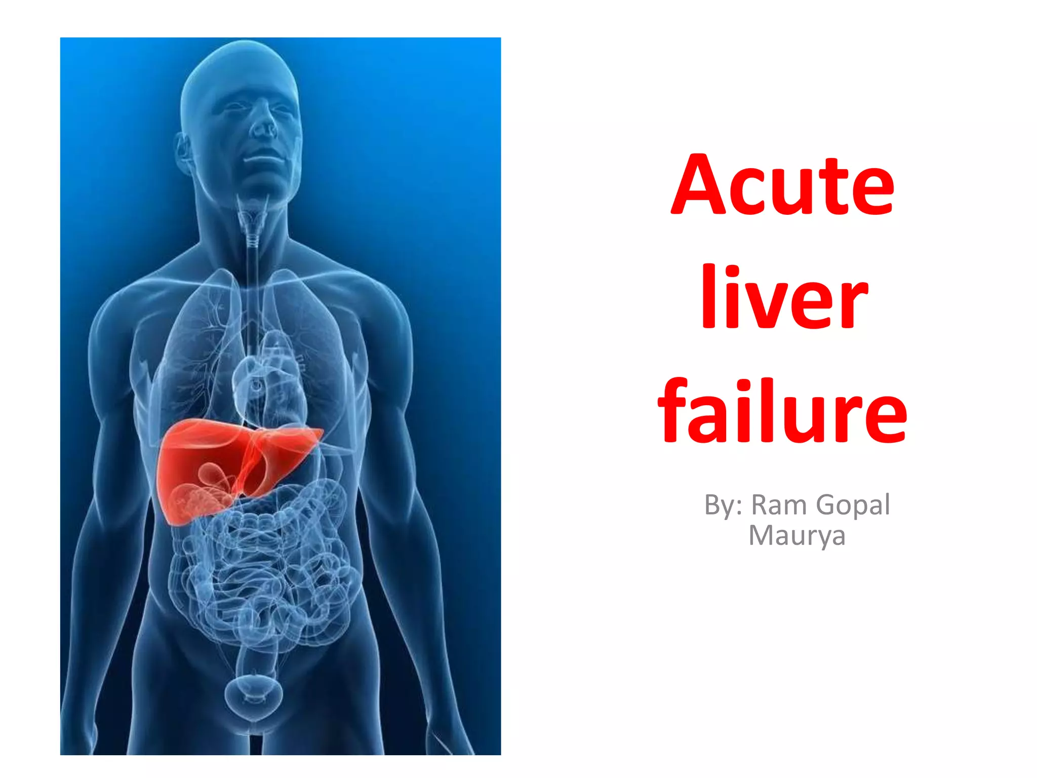 Acute liver failure | PPTX
