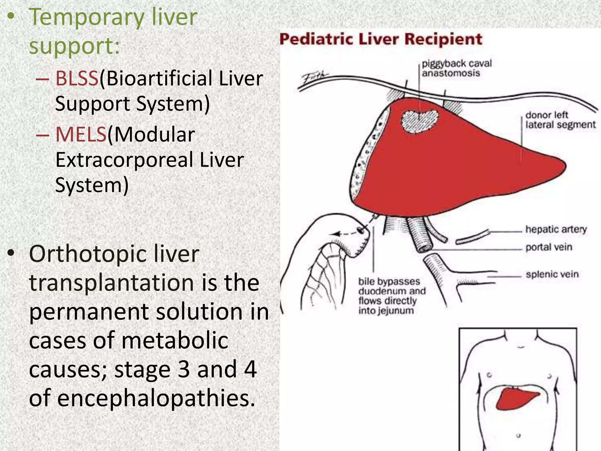 Acute liver failure in children | PPTX
