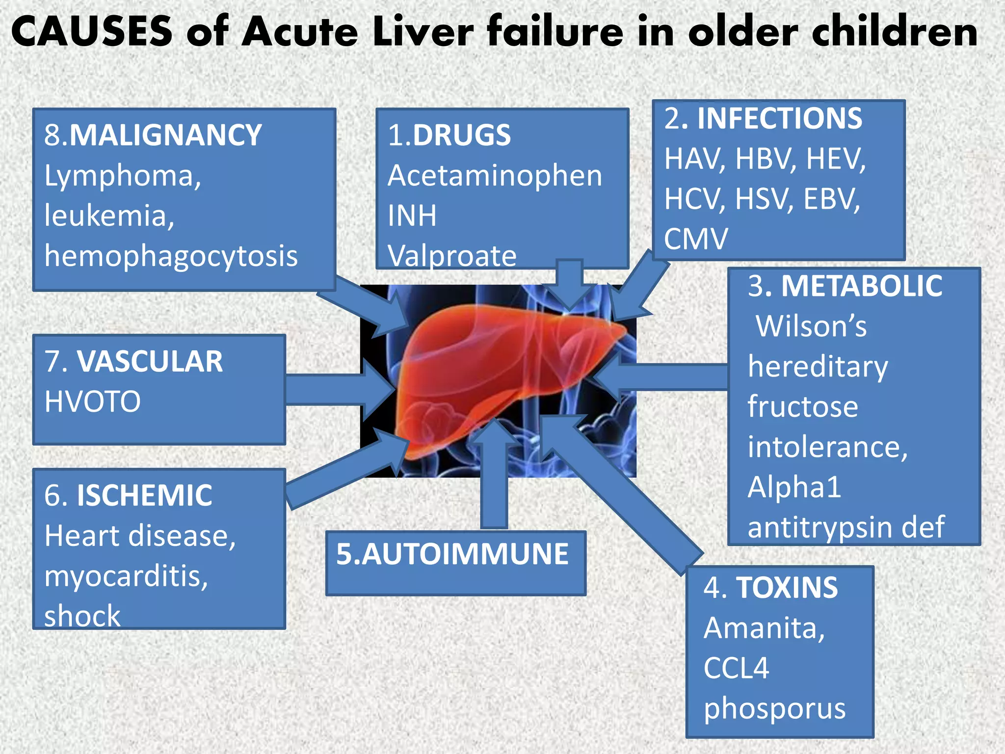 Acute liver failure in children | PPT