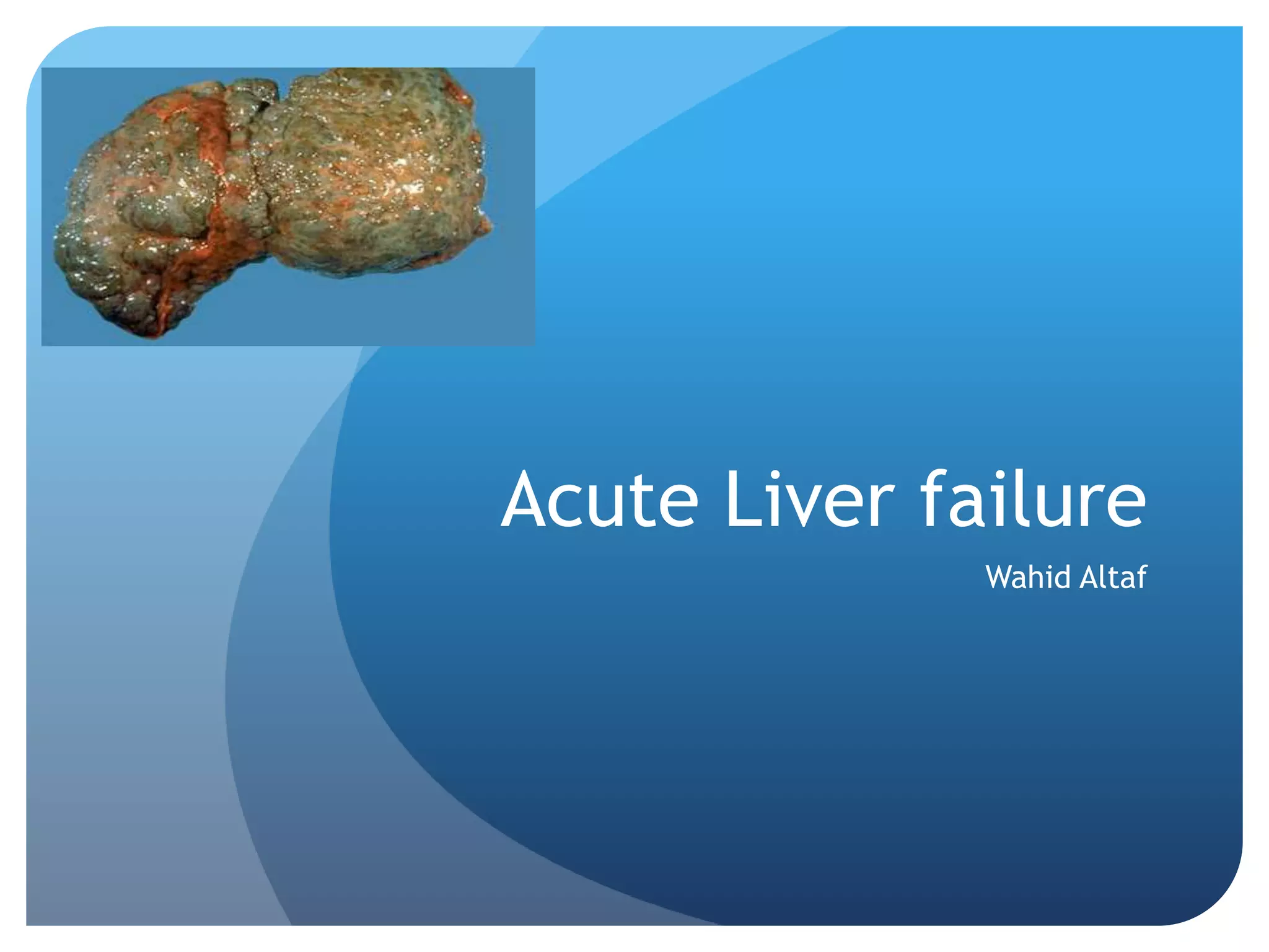 Acute liver failure in icu | PPTX