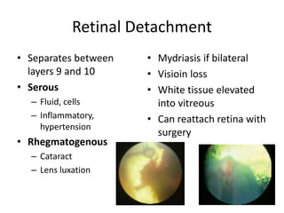 Acute loss of vision (ecc presentation) | PPTX