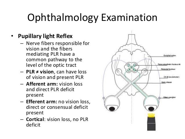 Acute loss of vision (ecc presentation)