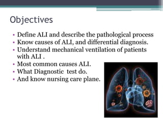 Acute lung injury | PPTX