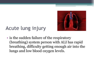 Acute lung injury | PPTX