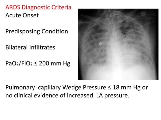 Acute lung injury & ards | PPT