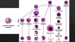 Acute Lymphoblastic Leukaemia (ALL)_Dr Dibyajyoti Prusty, MD.pptx