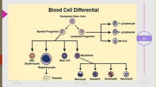 Acute Lymphoblastic Leukemai(ALL) essential .pptx