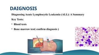 Acute lymphoblastic LeukemiaAAAAAAAAAAAAAAAAAA.pptx