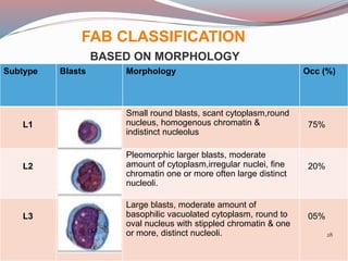 Acute Lymphoblastic Leukemia L1 L2 L3