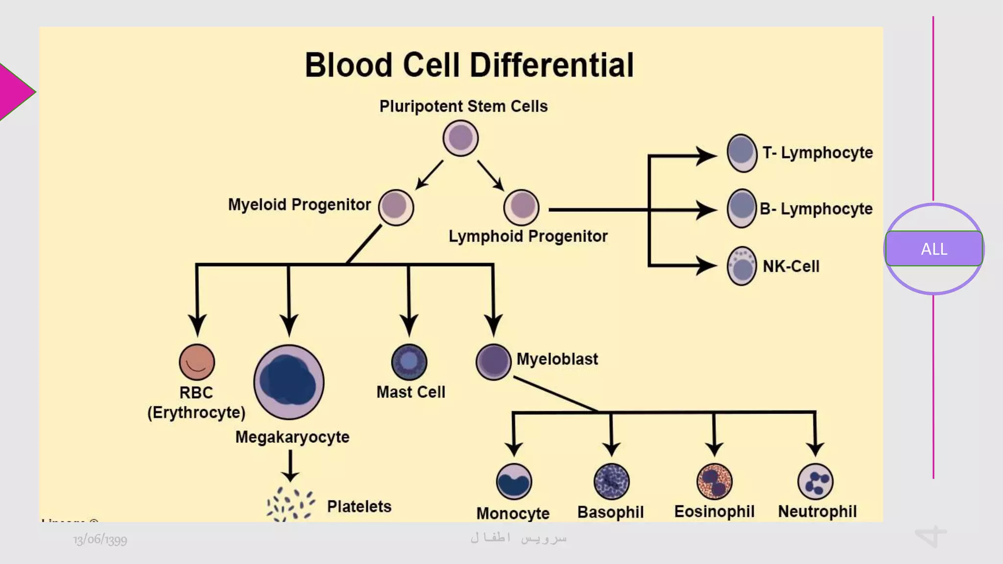 Acute lymphoblastic leukemia PPT, PDF | PPTX