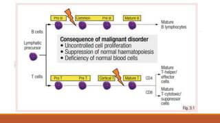 Acute Lymphoblastic Leukemia (ALL) | PPTX