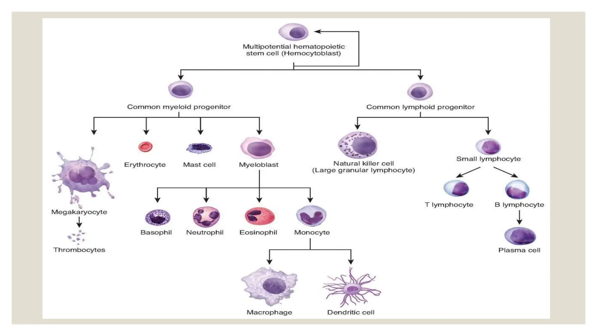 Acute lymphoblastic leukemia (all) (1).pptx