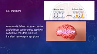 ACUTE MANAGEMENT OF SEIZURES IN CHILDREN.pptx