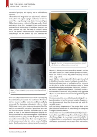 Acute massive gastric dilatation a surgical emergency | PDF