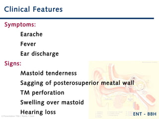 Mastoiditis Symptoms