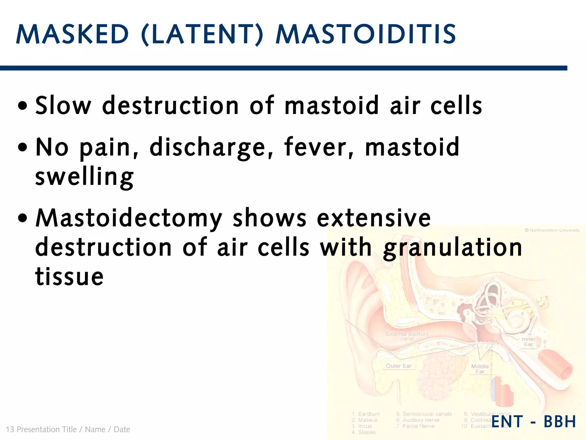 Acute mastoiditis lecture | PPT