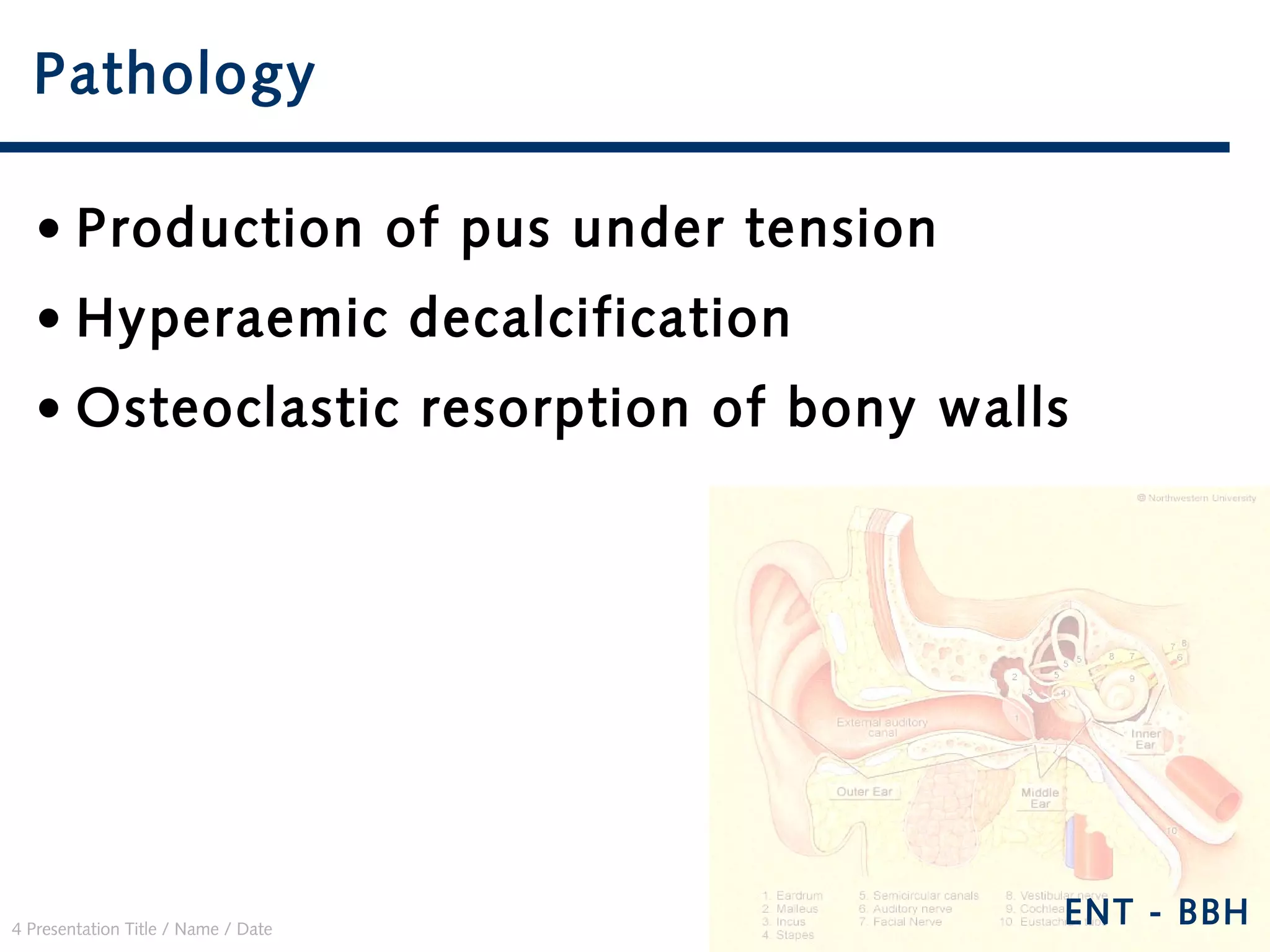 Acute mastoiditis lecture | PPT