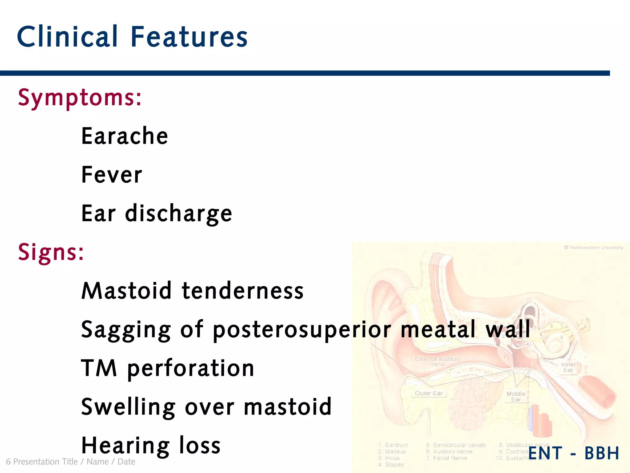 Acute mastoiditis lecture | PPT