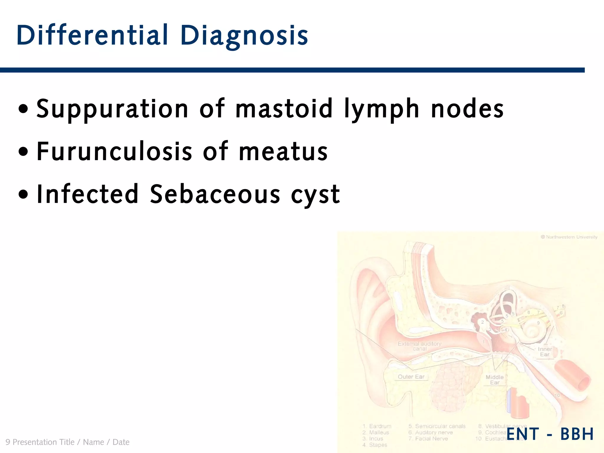 Acute mastoiditis lecture | PPT