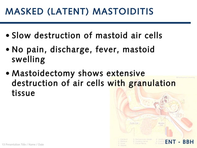 Acute mastoiditis lecture | PPT