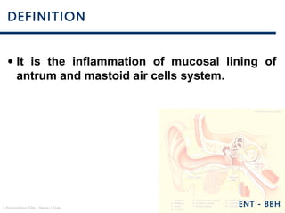 Acute mastoiditis lecture | PPT