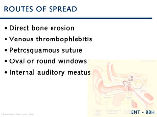 Acute mastoiditis lecture | PPT